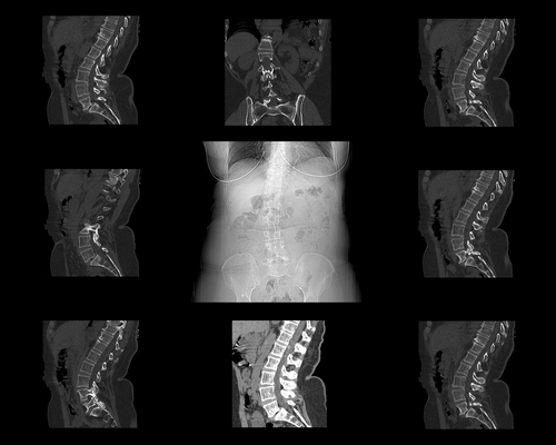 Taking Pictures of Your Spine